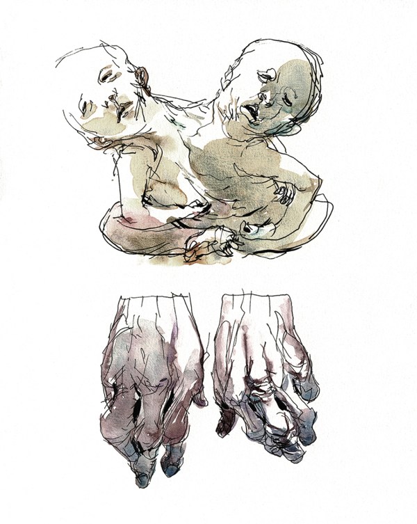 Sketching human frailty at the Mütter Museum Philadelphia | Citizen ...