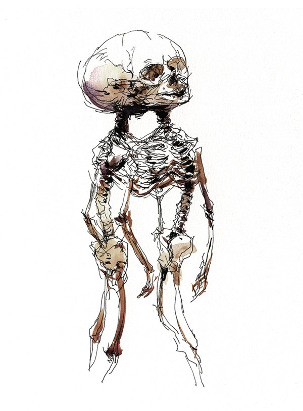Sketching human frailty at the Mütter Museum Philadelphia | Citizen ...